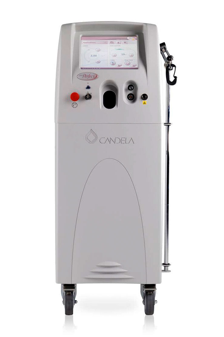 Vbeam Perfecta – North York Dermatology Clinic